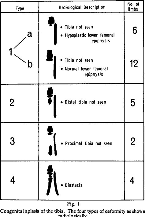 Figure 27 From Congenital Aplasia And Dysplasia Of The Tibia With