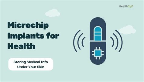 Microchip Implants For Health Storing Medical Info Under Your Skin
