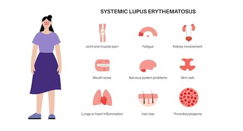Premium Vector Systemic Lupus Erythematosus