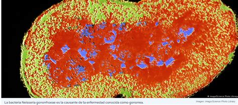 Aumenta La Resistencia A Los Antibióticos Contra La Gonorrea