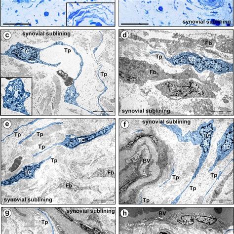 Morphology Of Human Synovium Lining And Sublining Layers Under Light Download Scientific