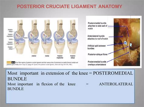 Arthroscopic Pcl Reconstruction Pptx