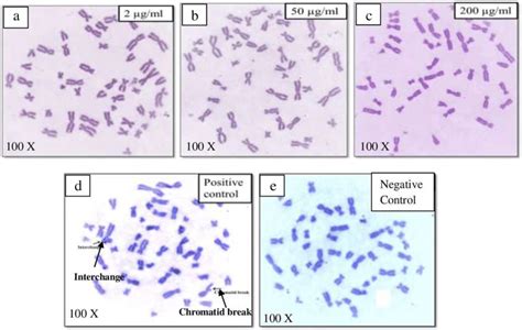 Chromosomal Aberrations At Different Concentrations Of Aunps A 2μgml Download Scientific