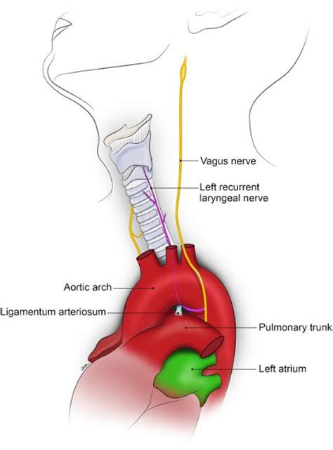 Left Recurrent Laryngeal Nerve