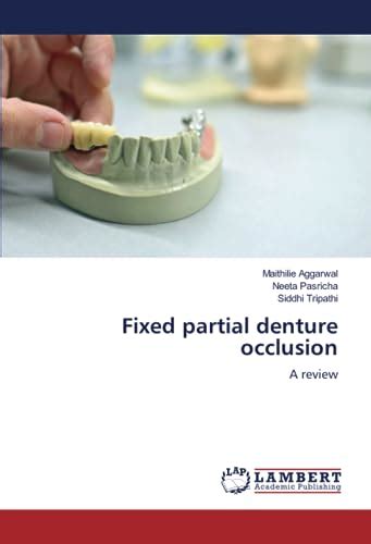 Fixed Partial Denture Occlusion A Review Aggarwal Maithilie