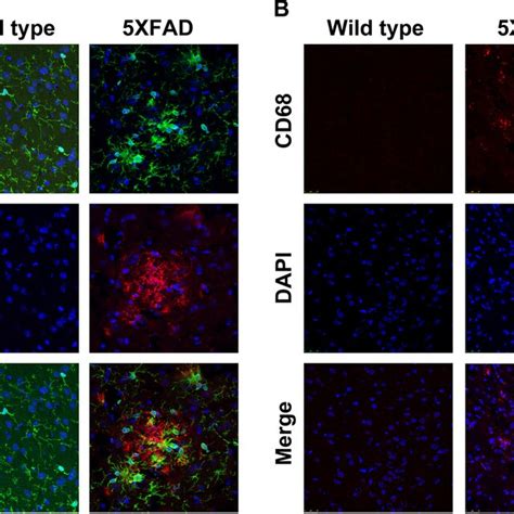 Microglial Proliferation And Activation In The Alzheimers Mouse Brain