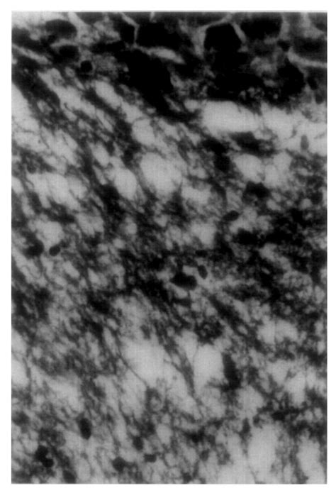 Optic Tract In The Area Of The Supraoptic Nucleus In An Hcp Treated Download Scientific Diagram