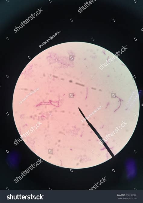 Bacillus Cereusbacteria Gram Positivemicroscopesciencebacteriascience