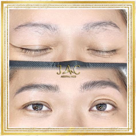 Eyebrow Retouch Jac Aesthetics
