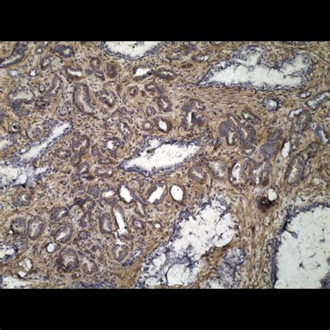 Cil33347 Homo Sapiens Endocrine Paracrine Cell Of Prostate Gland