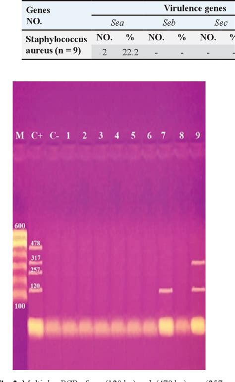 Figure 2 From Screening Of Antibiogram Virulence Factors And Biofilm