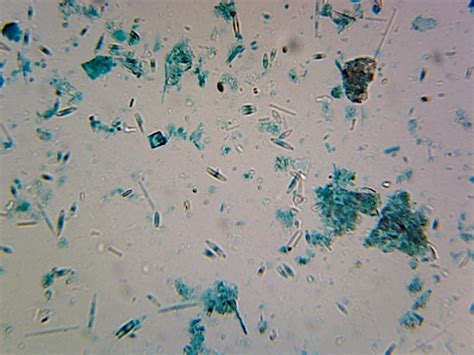 Dyatomeae Mixed Diatoms Microscope Slide Industrial