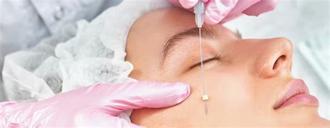 Sugar Threads Lift In Memphis Pdo Non Surgical Facelift