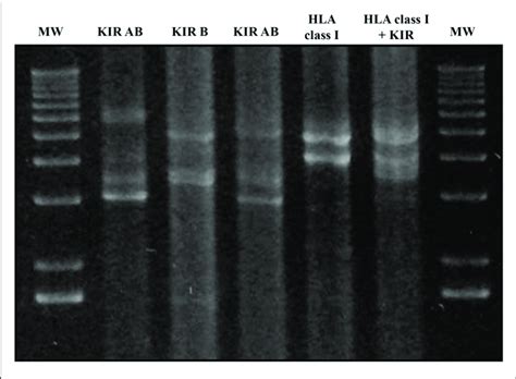 Agarose Gel Electrophoresis 1 Of Kir And Hla Class I Multiplex Download Scientific Diagram
