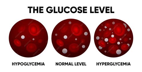 Hyperglycemia