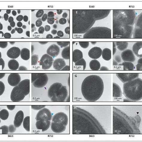Daptomycin Chemical Structure Download Scientific Diagram