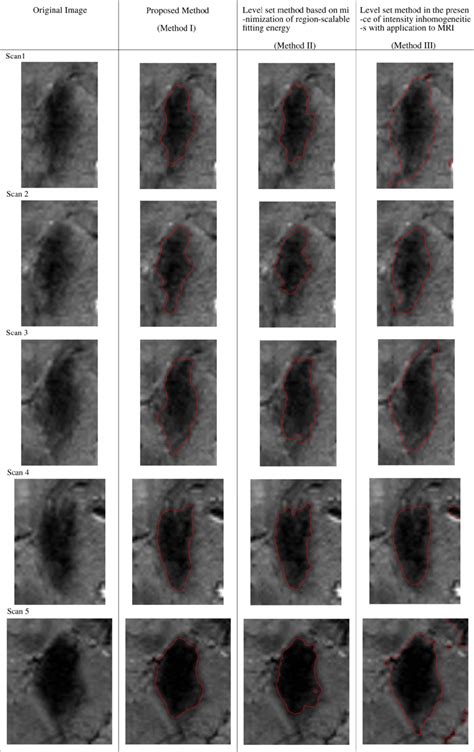 Comparison Of Segmentation Results Of Our Proposed Method With