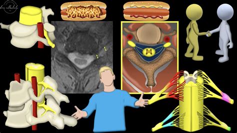 1feeling Unarmed When It Comes To Evaluating Cervical Radiculopathy