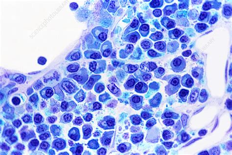 Lymph Node Medulla Light Micrograph Stock Image C0620290 Science Photo Library