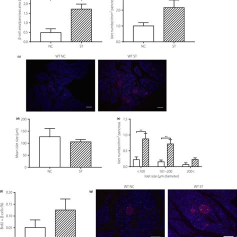 Morphological Analysis Of Islets In Wild‐type Wt Mice A β‐cell Download Scientific Diagram