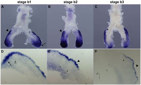 Fgf10 Expression Pattern In Early Stages Of Chick Lung Development Download Scientific Diagram