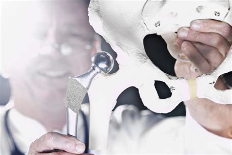 Causes Effects And Treatments Of Osteolysis Health And Detox And Vitamins