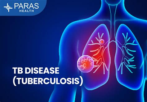 What Is Tuberculosis Tb Symptoms Causes And Treatment
