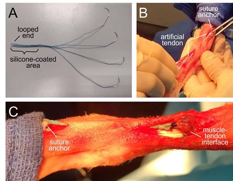 Polyester Silicone Coated Pet Si Artificial Tendon A Artificial