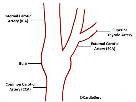 Carotid Artery Anatomy Cardioserv