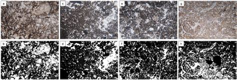 Measurement Of Void Abundance By Image J A B Compound Packing Void