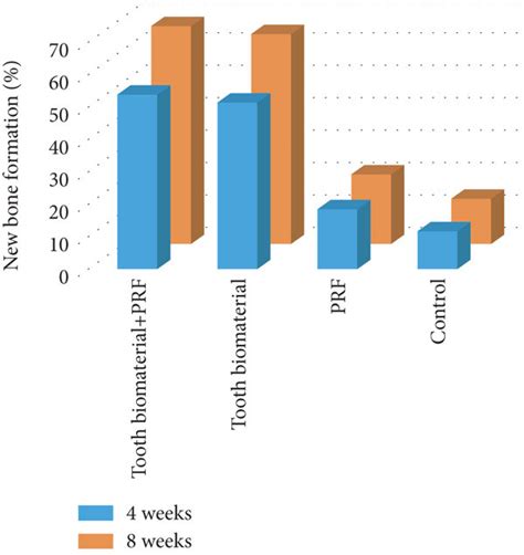 Result Of Histomorphometric Analysis Total New Bone Formation At 4