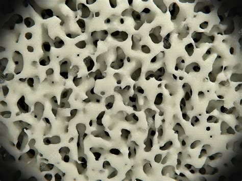 Healthy Bone Tissue Illustration Stock Image F0366182 Science