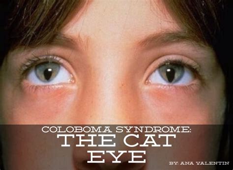 Cat With Triangle Pupil Rmildlyinteresting