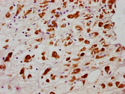 Phospho Mlkl Ser358 Recombinant Rabbit Monoclonal Antibody 4a6