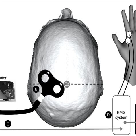 Flow Chart Of Tms Protocol Development And Standardization Procedures Download Scientific Diagram