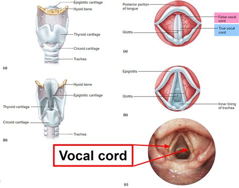 Vocal Cord Paralysis Causes Symptoms Recovery Surgery Treatment