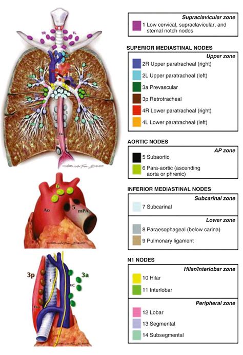 Lung Cancer Surgical Treatment Clinical Tree