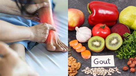 Check Out 5 Foods To Lower Your Uric Acid Levels Naturally Womans