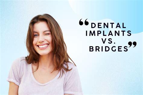 Dental Implants Vs Bridges