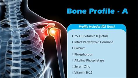 Bone Profile What Tests Does It Contain Healthy Food Near Me