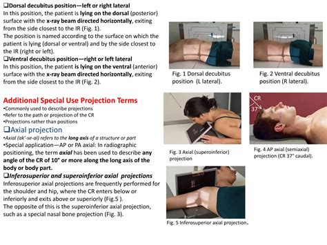 General Radiological Procedure Pptx