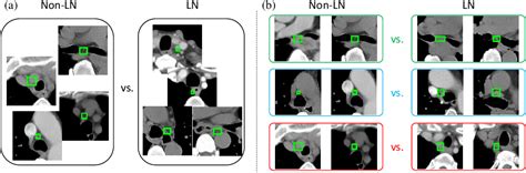 figure 3 from anatomy aware lymph node detection in chest ct using