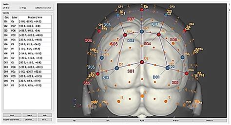 Optodes Positioning In The Fnirs Cap Consisting Of 8 Emitters And 7