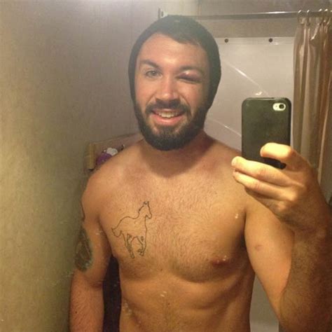 Periphery Vocalist Spencer Sotelo Shows Off His Black Eye