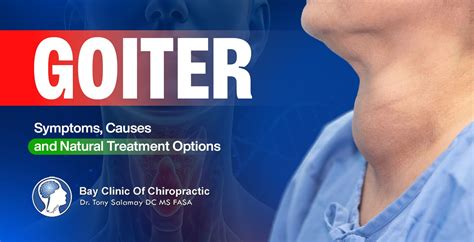 Goiter Symptoms Causes And Natural Treatment