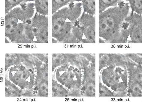 Microcolony Formation And Fusion Excerpts Of Video S1 During Download Scientific Diagram
