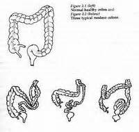 Observia What A Long Strange And Tortuous Colon Its Been