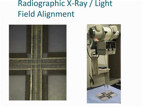 Ppt Quality Control In Diagnostic Radiology Powerpoint Presentation