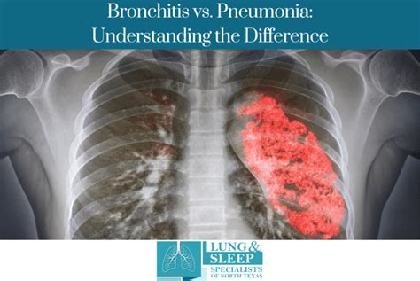 Bronchitis Vs Pneumonia Understanding The Difference Lung And Sleep