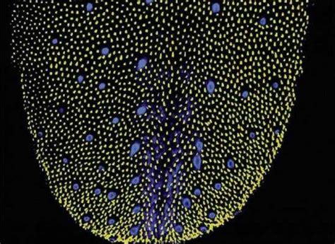 味觉天才的舌头有多少个味蕾？味觉白痴喜欢重口味？食物